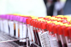Understanding Pregnancy Blood Tests | American Pregnancy Association