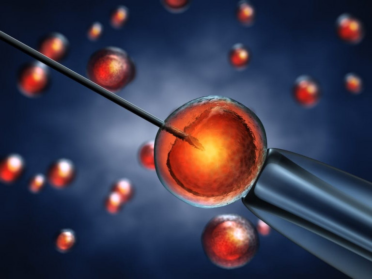 Intracytoplasmic Sperm Injection: ICSI | American Pregnancy Association